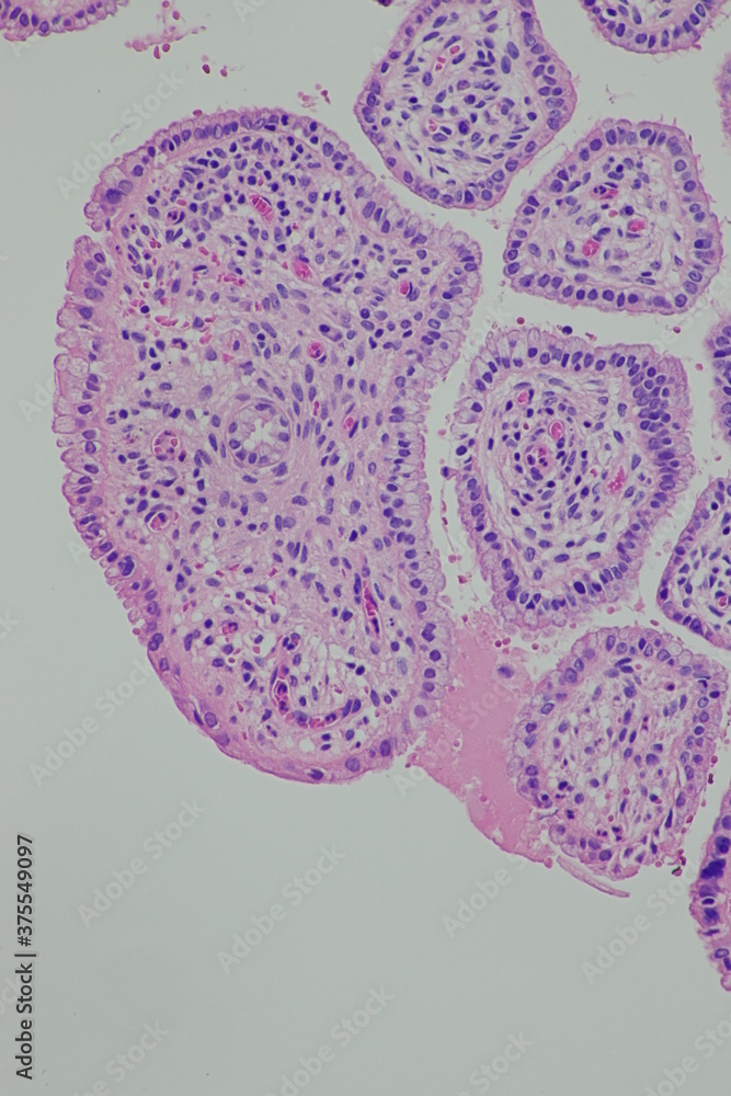 Foto de Normal endocervical tissue, photo under microscope ...