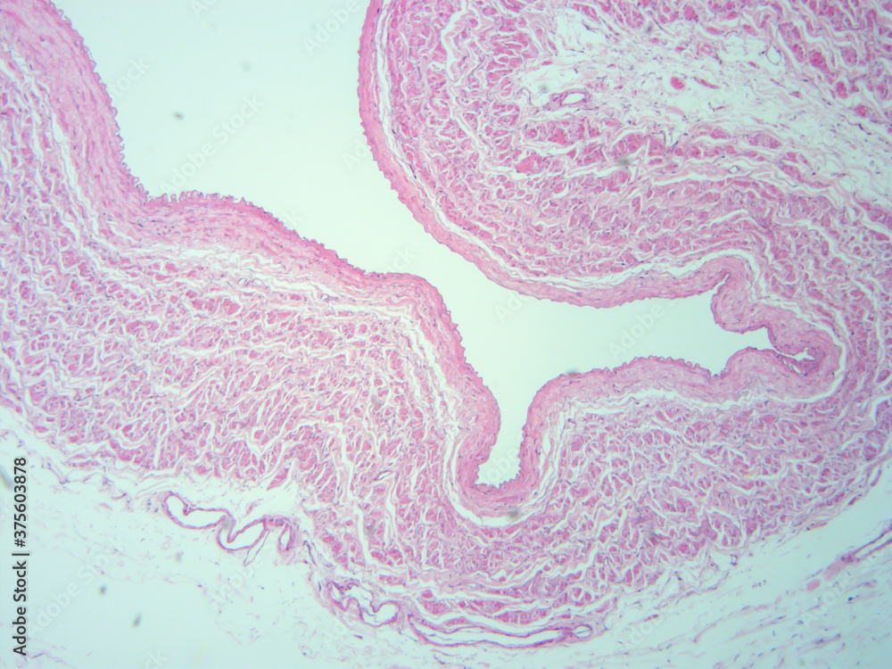 picture of histology human tissue with microscope from laboratory (not ...