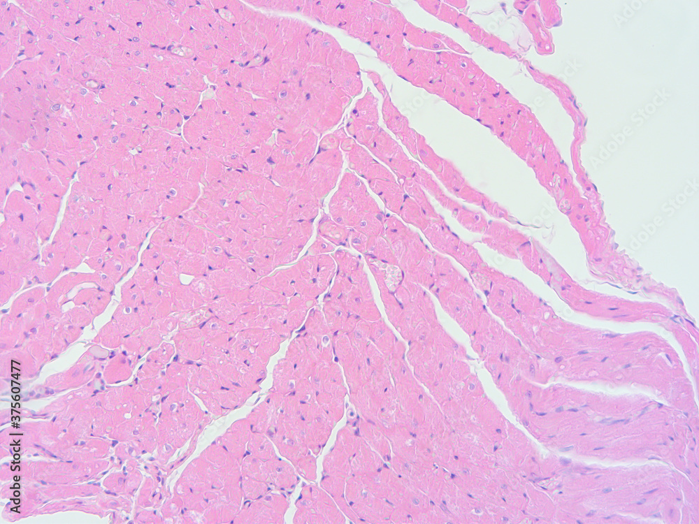 picture of histology human tissue with microscope from laboratory (not ...