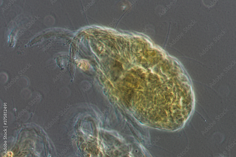 peach pest mite worm, micrograph Stock-Foto | Adobe Stock