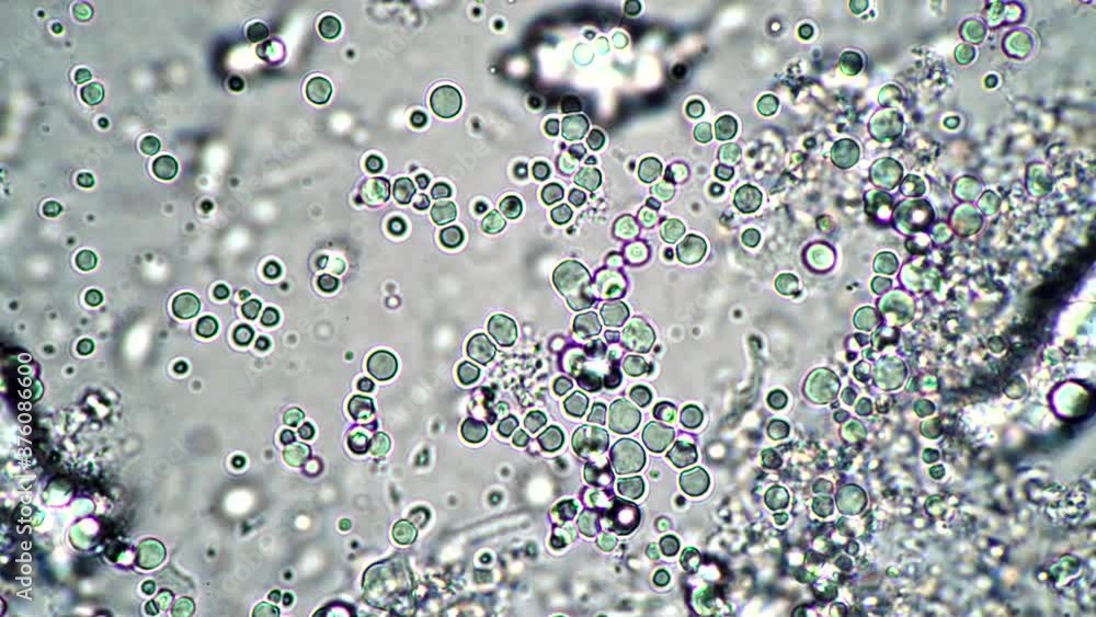 Lactobacilli in breast yeast under magnification of the microscope ...