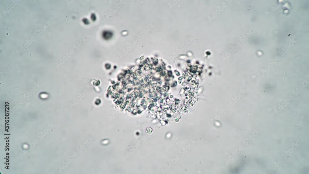 Vidéo Stock Raging diverse life in a drop of water under a microscope ...