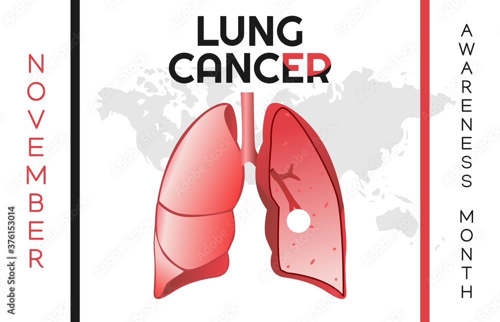 Vector graphic of lung cancer awareness month good for lung cancer ...