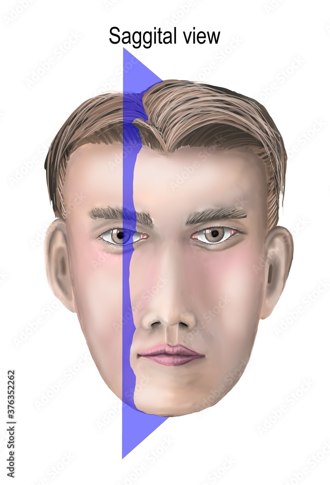 the difference slides of brain imaging regarding to CT and MRI images ...