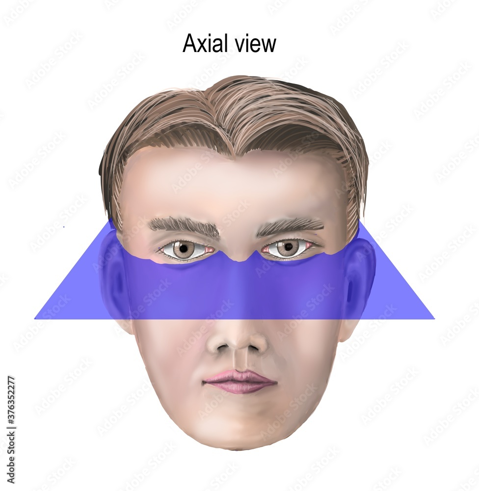 the difference slides of brain imaging regarding to CT and MRI images ...
