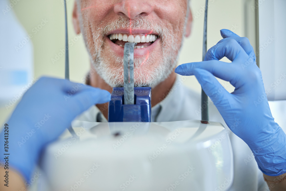 Aging man biting a blocker of a panoramic x-ray machine Stock Photo ...