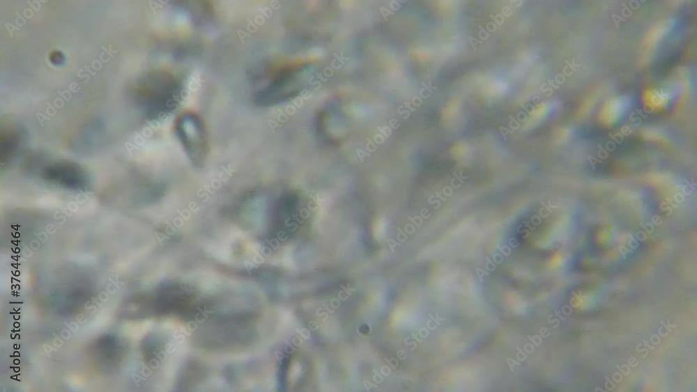 Moving Human Sperm Under Phase Contrast Microscope Sperm Spermatozoa