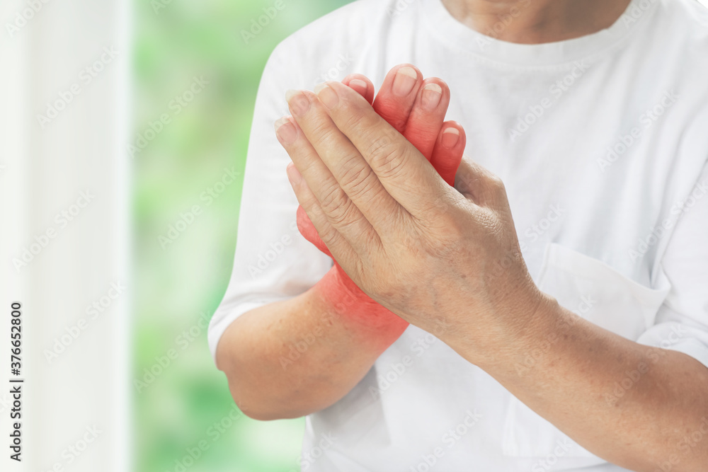 Old women Hands with beriberi Disease causing inflammation of the ...