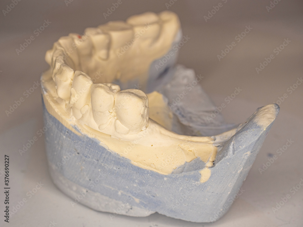 Photo & Art Print Model of plaster cast of lower teeth, rdonar