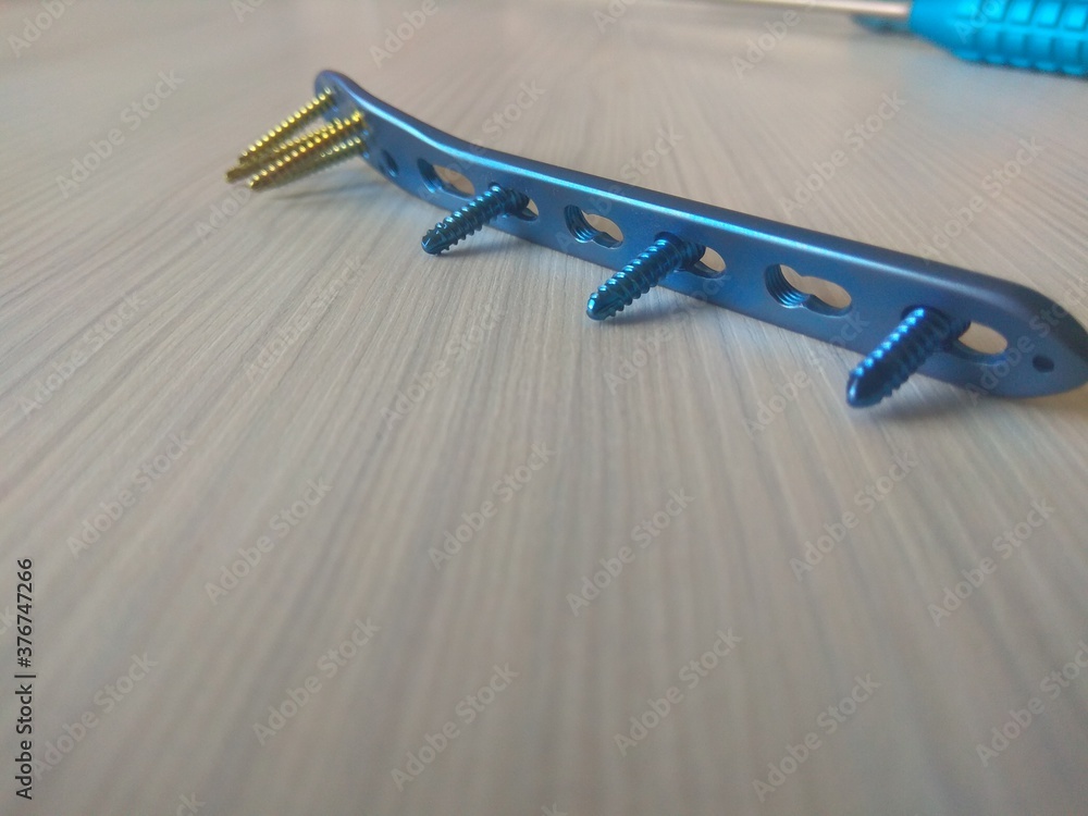 Surgical plates in traumatology for treatment bone fracture Stock Photo ...