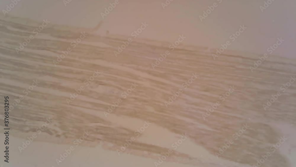 Microscope Dog Skeletal Muscle Cross Section x1200 Slide In Stock Video ...