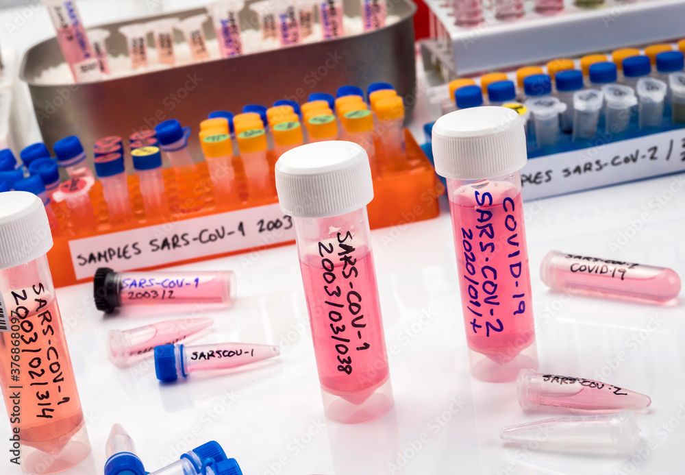 Vials with samples of SARS-COV-1 prepared cold in a laboratory ...