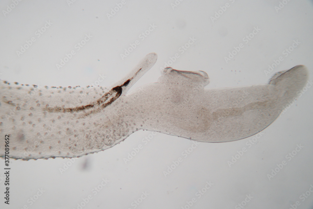 The study parasite or worms is a freshwater fish parasite in laboratory ...