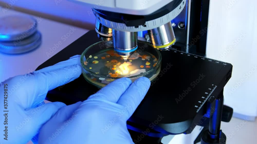 Video „Scientist moves a Petri dish with bacteria under a microscope ...