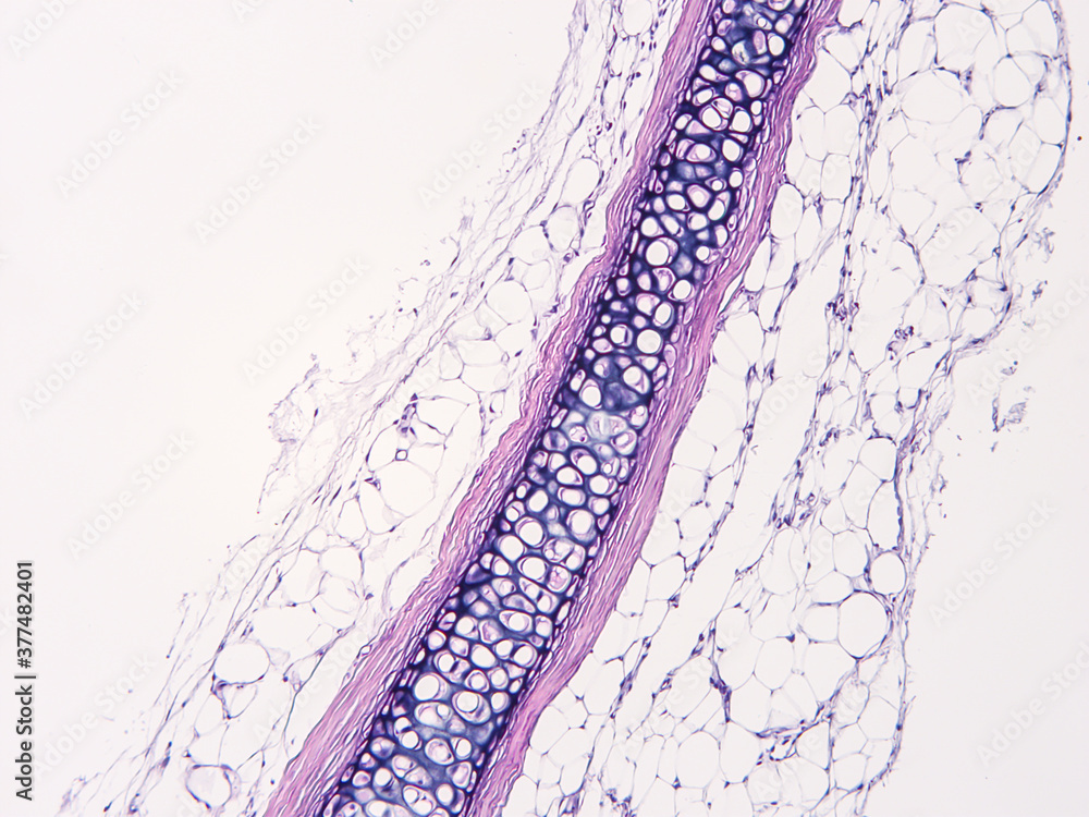 Histology of human tissue, show epithelial tissue and connective tissue ...