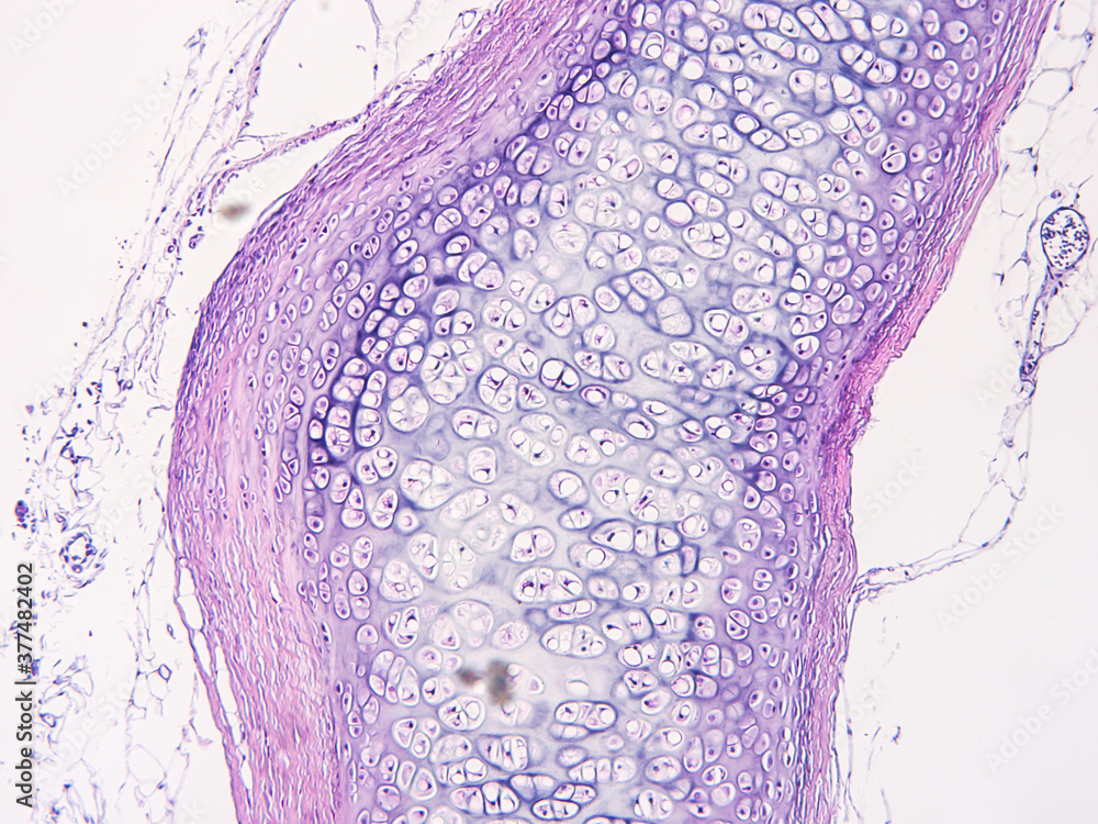 Histology of human tissue, show epithelial tissue and connective tissue ...