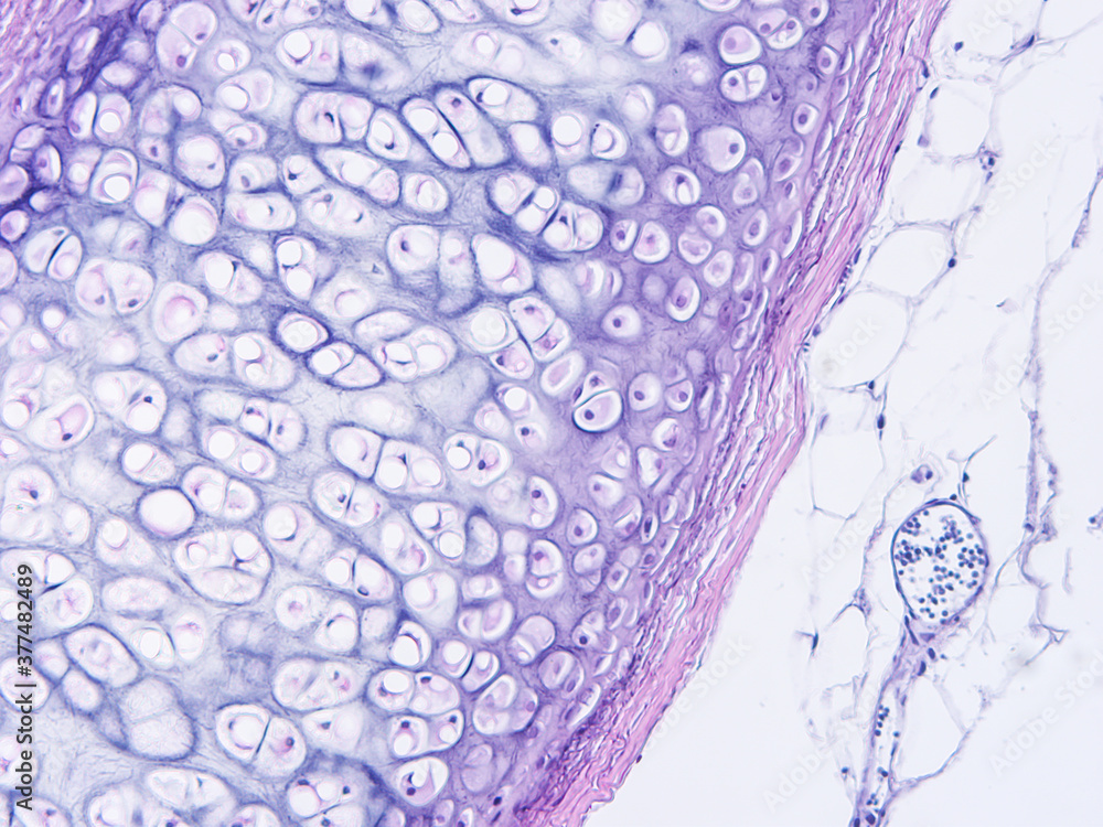 Histology of human tissue, show epithelial tissue and connective tissue ...