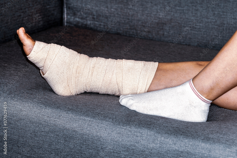 Woman with broken leg. female bandaging foot on the floor. The concept ...