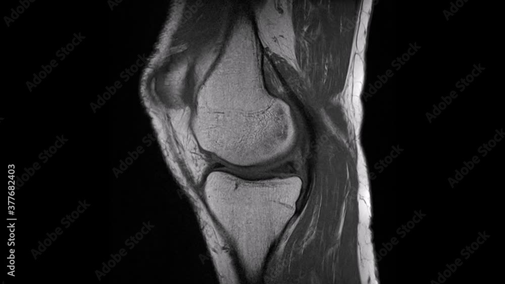 Radiologie: Serie von Einzelbildern - MRT-Aufnahmen eines männlichen ...