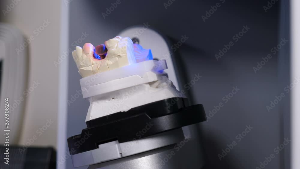 Dental technician scanning dental cast model in 3D surface scanners ...