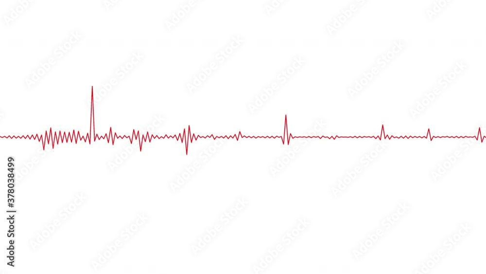 Electrocardiogram is a medical examination to see the electrical ...