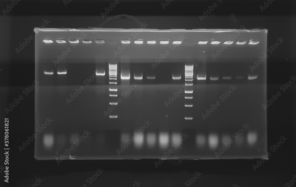 Ilustrace „result Of Agarose Gel Electrophoresis Of Pcr Products
