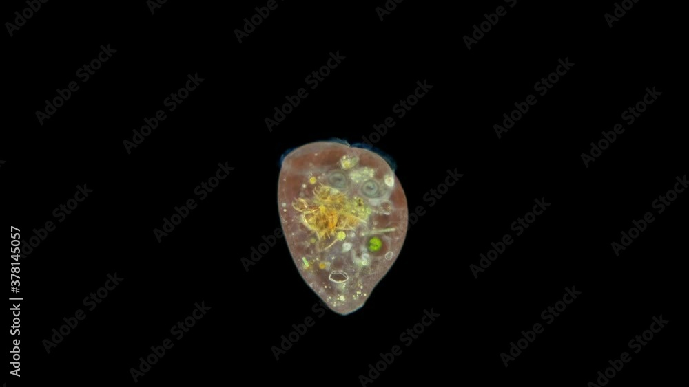 Infusoria Stentor under the microscope, the family Stentoridae, class ...