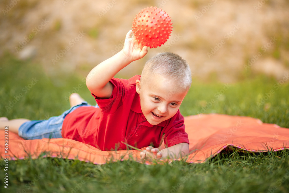A boy with Down syndrome holds a red ball in his hands, a genetic ...