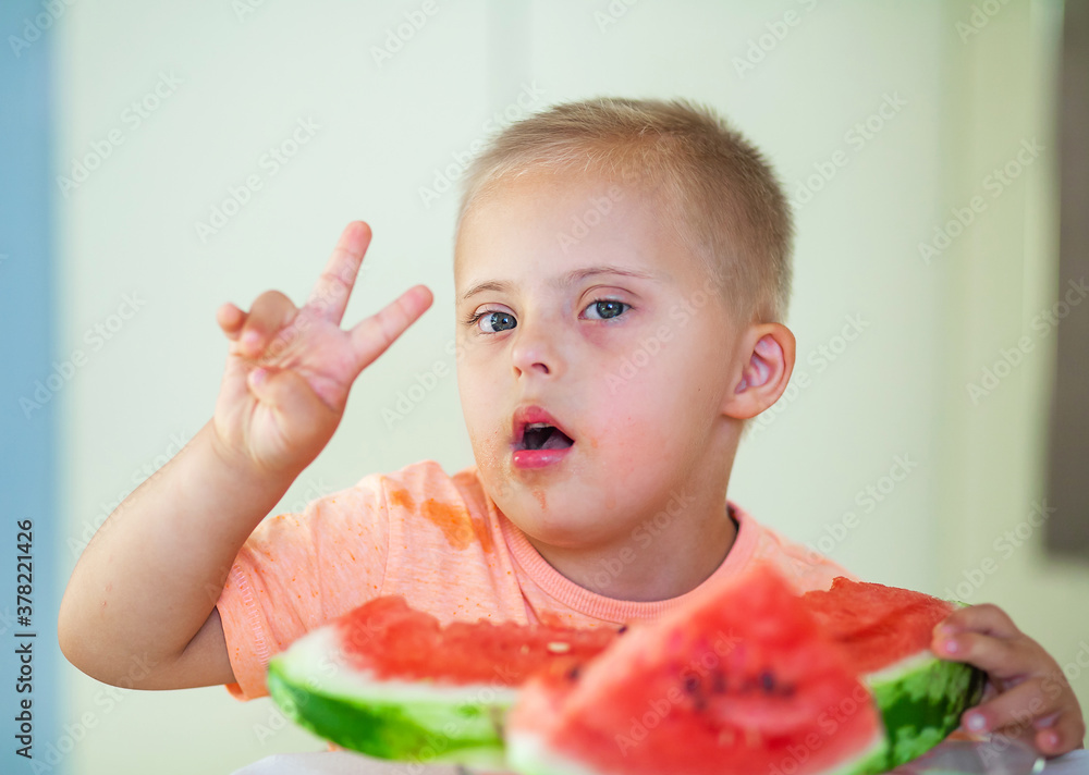 Little cute boy with Down Syndrome eating watermelon, disabled children ...
