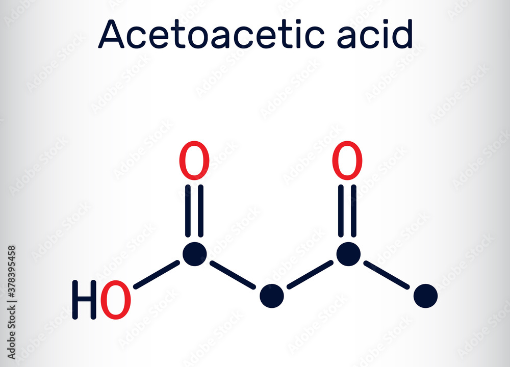 Acetoacetic acid, diacetic, oxobutanoic acid molecule. It is a ketone ...
