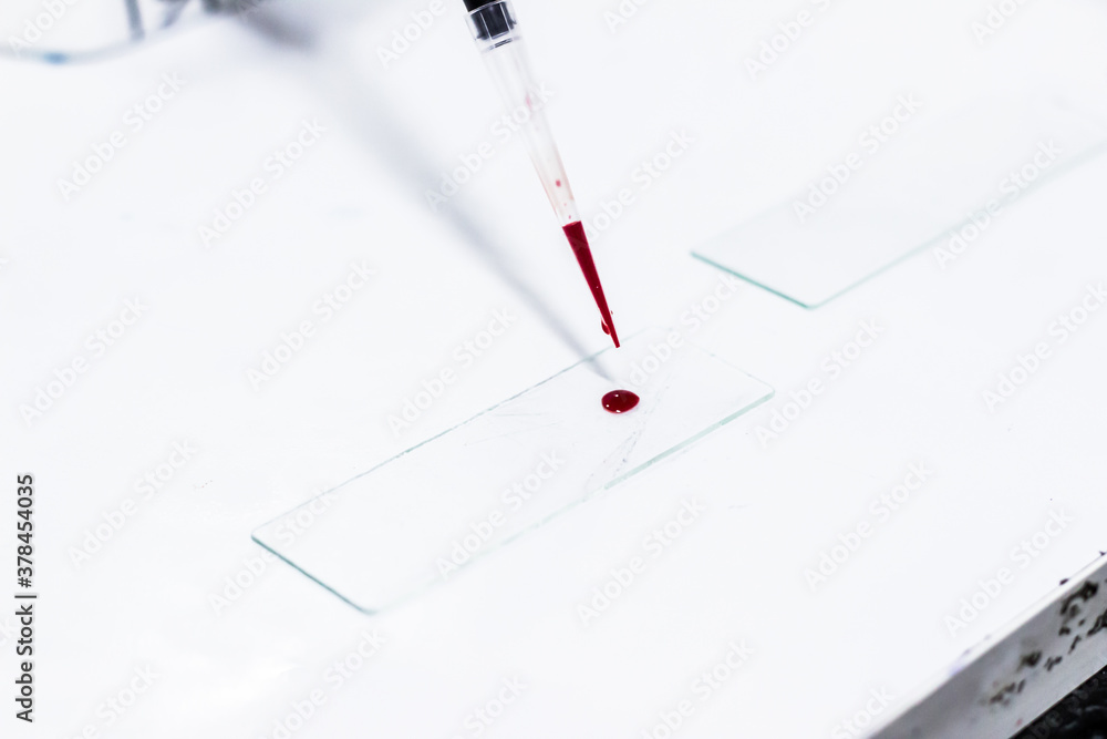 drop of blood on a glass slide using micropipette microtip Stock Photo ...