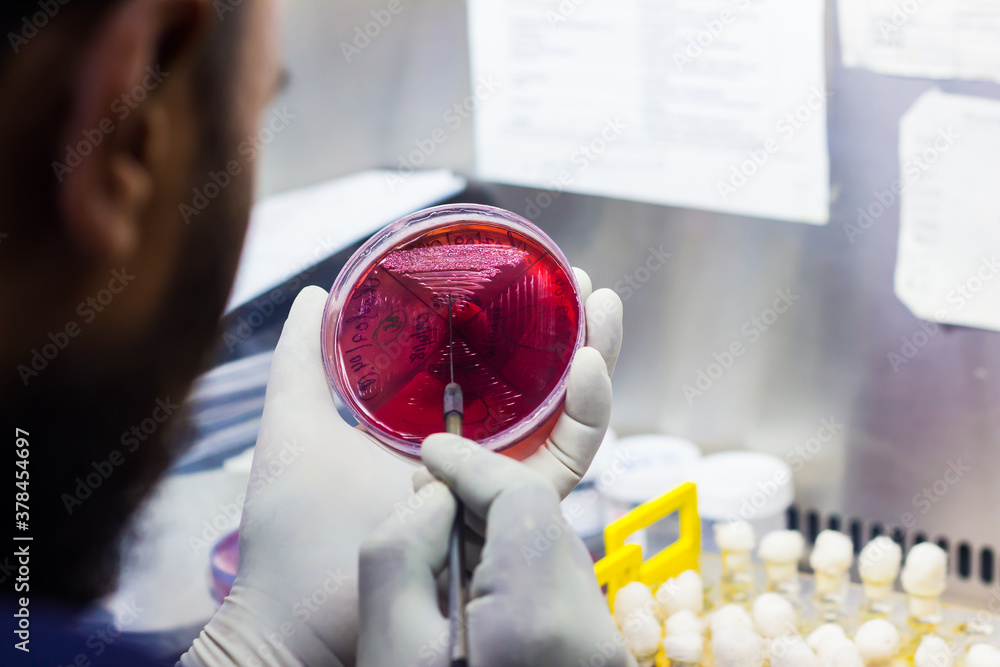 Bacterial Inoculation on a culture plate using inoculation loop by ...