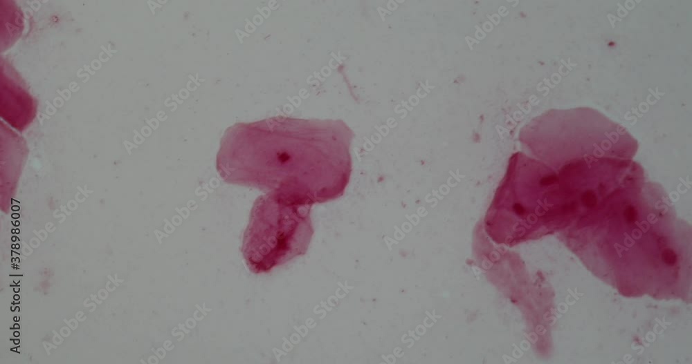 cells of the oral mucosa with cell nucleus and bacteria at high ...