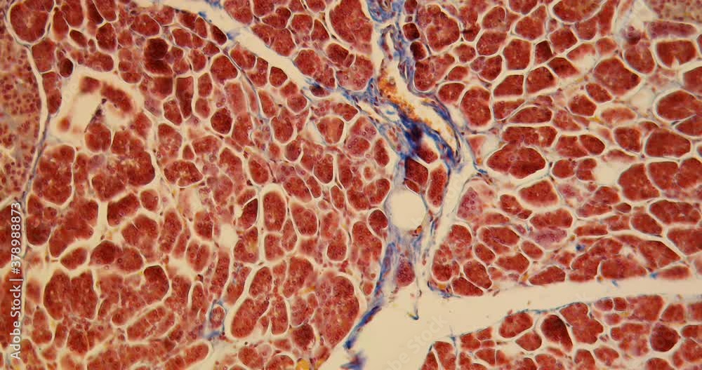 Pancreas with islet cells of Langerhan at high magnification under the ...