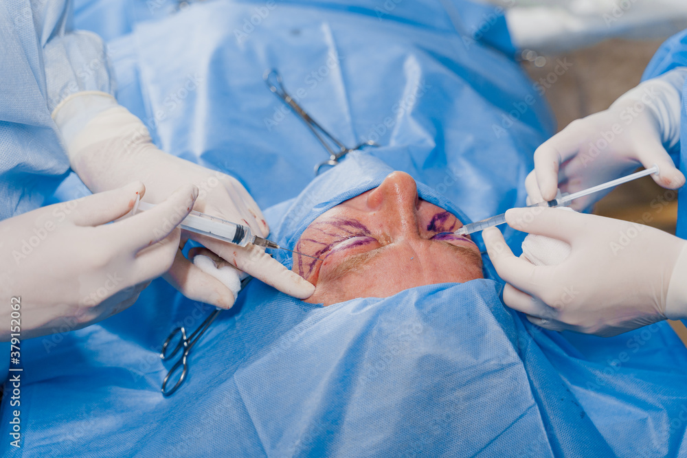 Close-up anesthesia before blepharoplasty and lipofilling plastic ...