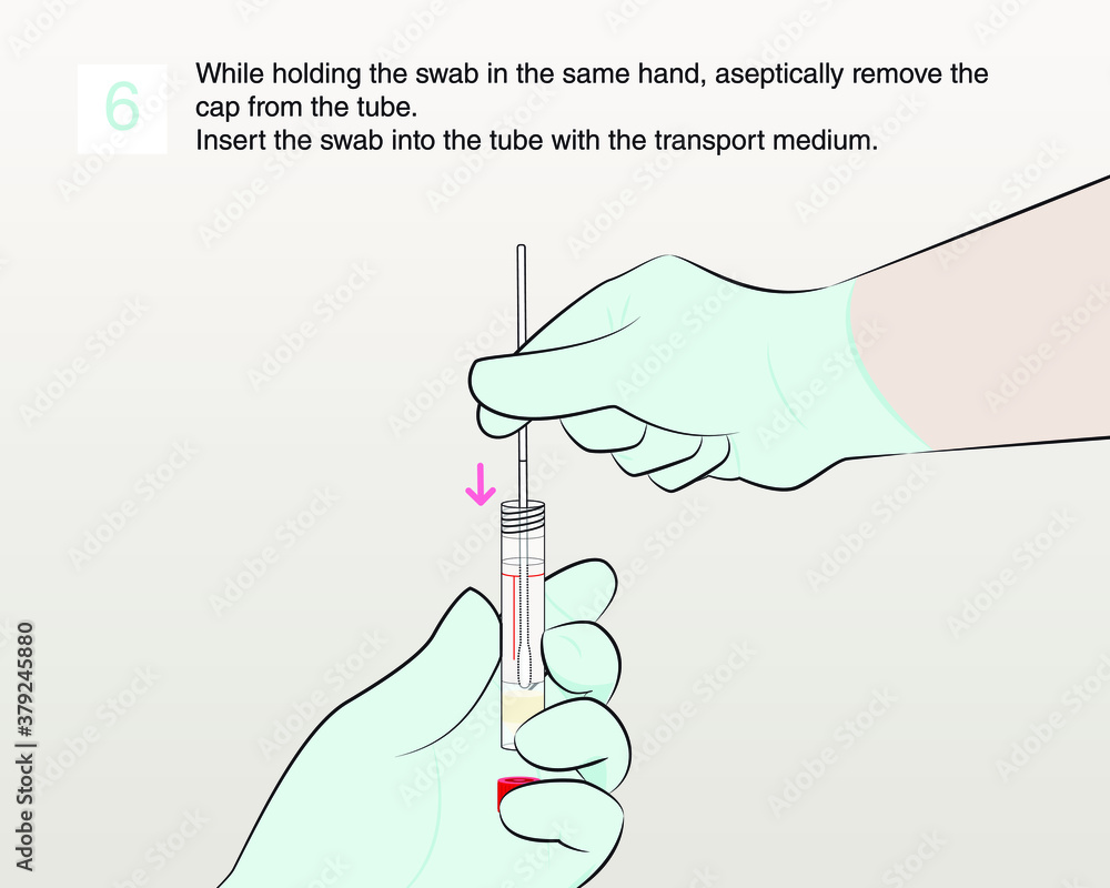 While holding the swab in the same hand, aseptically remove the cap ...