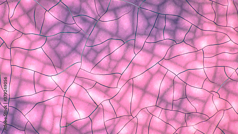 Photomicrograph of fine needle aspiration (FNA) cytology of a thyroid ...