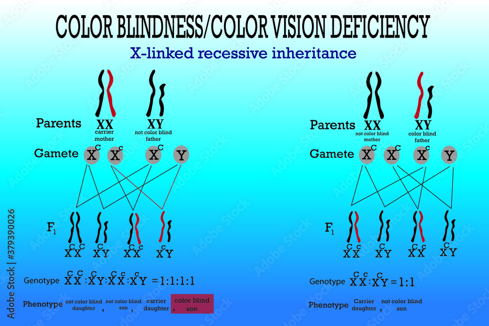 Color blindness genetics on X chromosome. X-linked gene Stock Vector ...