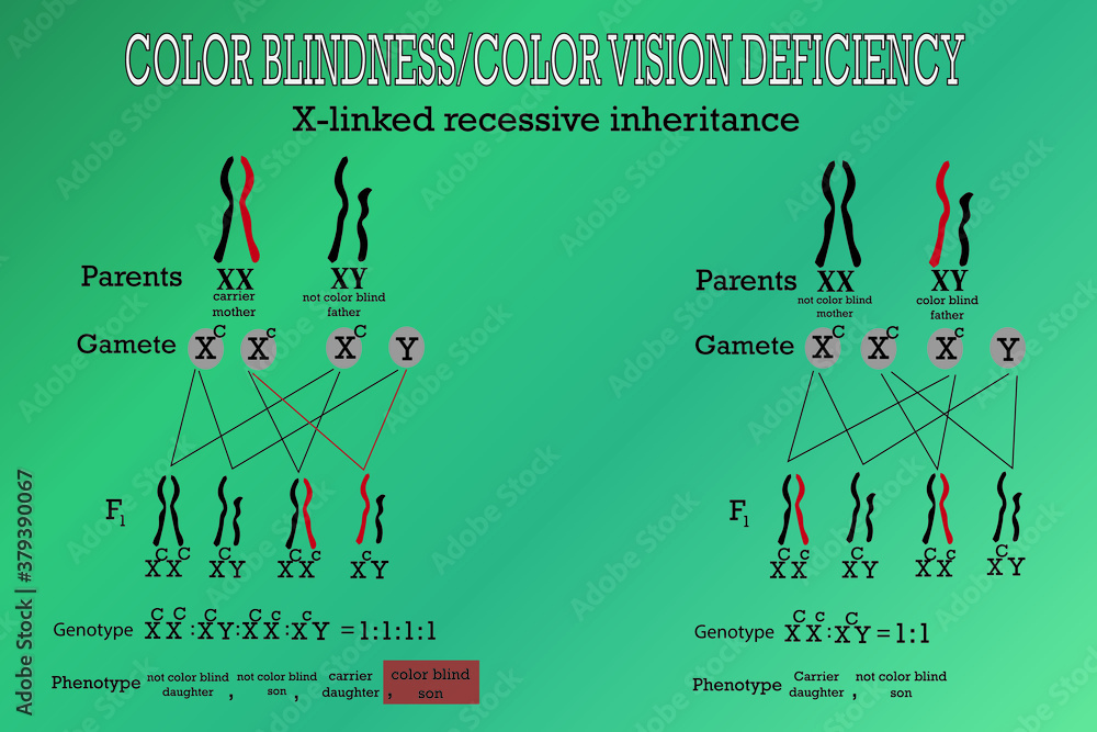 Color blindness genetics on X chromosome. X-linked gene Stock Vector ...