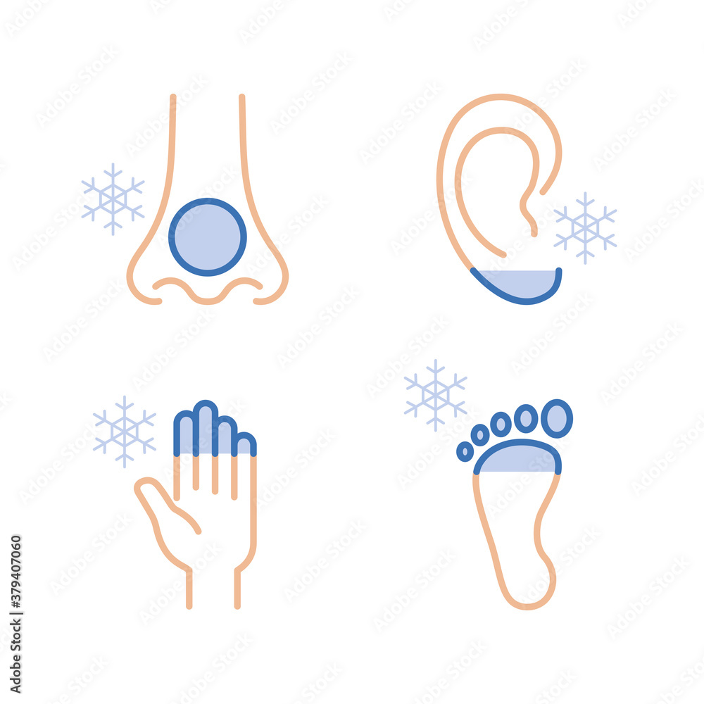 Frostbite of hands, foot, ears and nose. Hypothermia. Medical ...