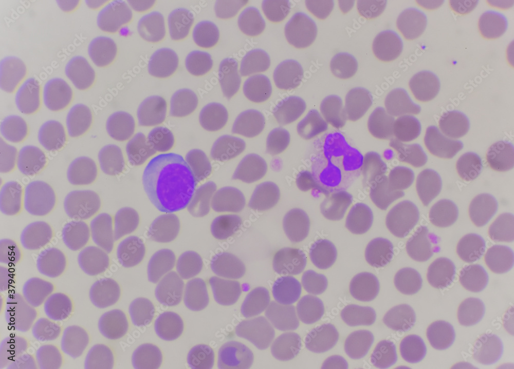 Red blood cells science background. Stock Photo | Adobe Stock