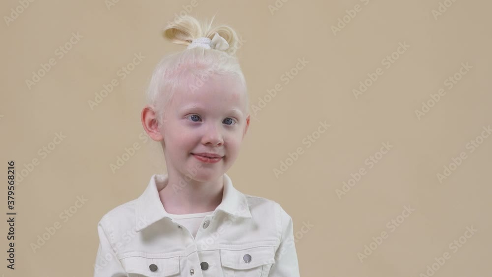 little fashion model, kid girl with abnormal deviations, unusual ...