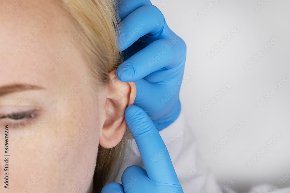 Darwin's tubercle on the ear. The girl at the reception at the plastic ...