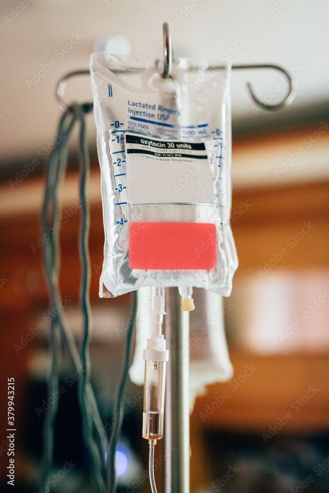 IV infusion of sinthetic oxytocin (Pitocin) Stock Photo | Adobe Stock