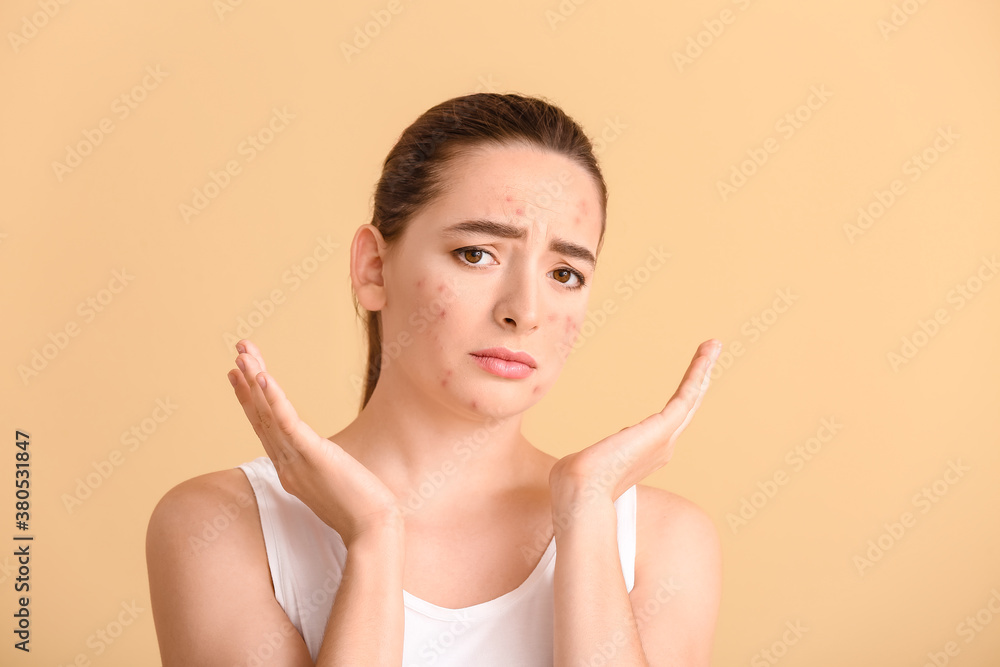 Sad young woman with acne problem on color background Stock Photo ...