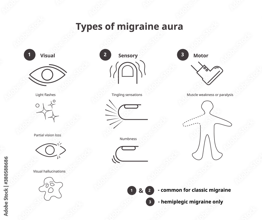 Types Of Migraine Aura Sensory Visual And Motor Aura Of The Classic And Hemiplegic Migraine