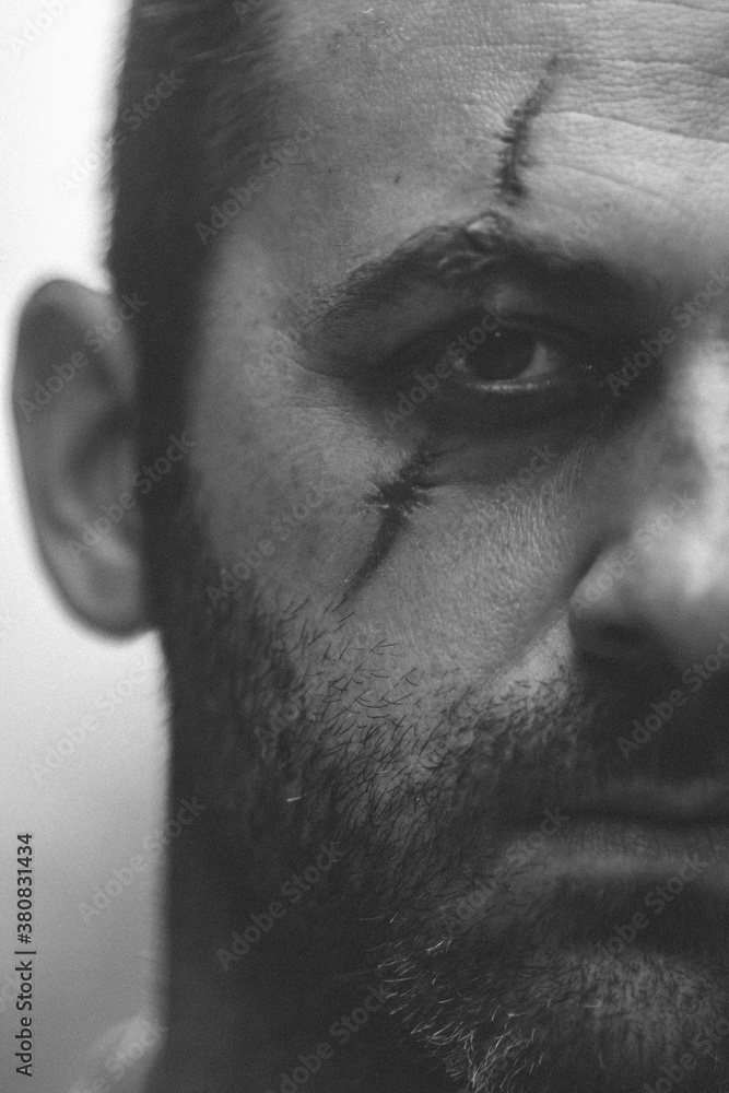 scar,black and white portrait Stock Photo | Adobe Stock