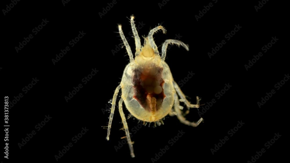 Acari (mite) living in water under a microscope, the superfamily ...