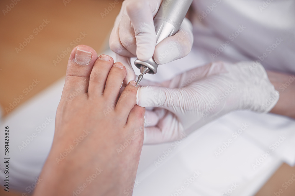 Hardware medical pedicure with nail file drill apparatus. Patient on ...