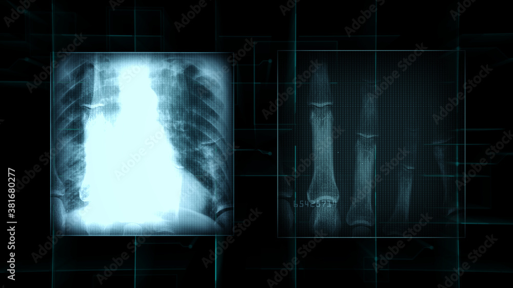X-ray film of human digital effect display with 3d rendering. Stock ...